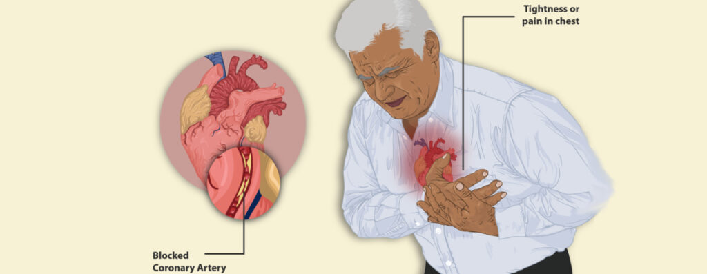 Angina Treatment in Jaipur By Dr. Divij Khetan | Khetan Hospital